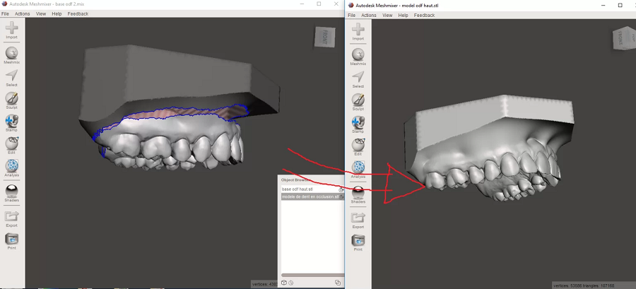 Meshmixer数字牙科实践 - BimAnt