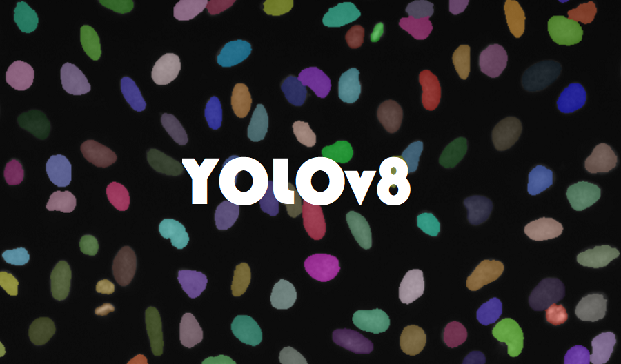 How To Train YOLOv8 Segmentation On A Custom Dataset
